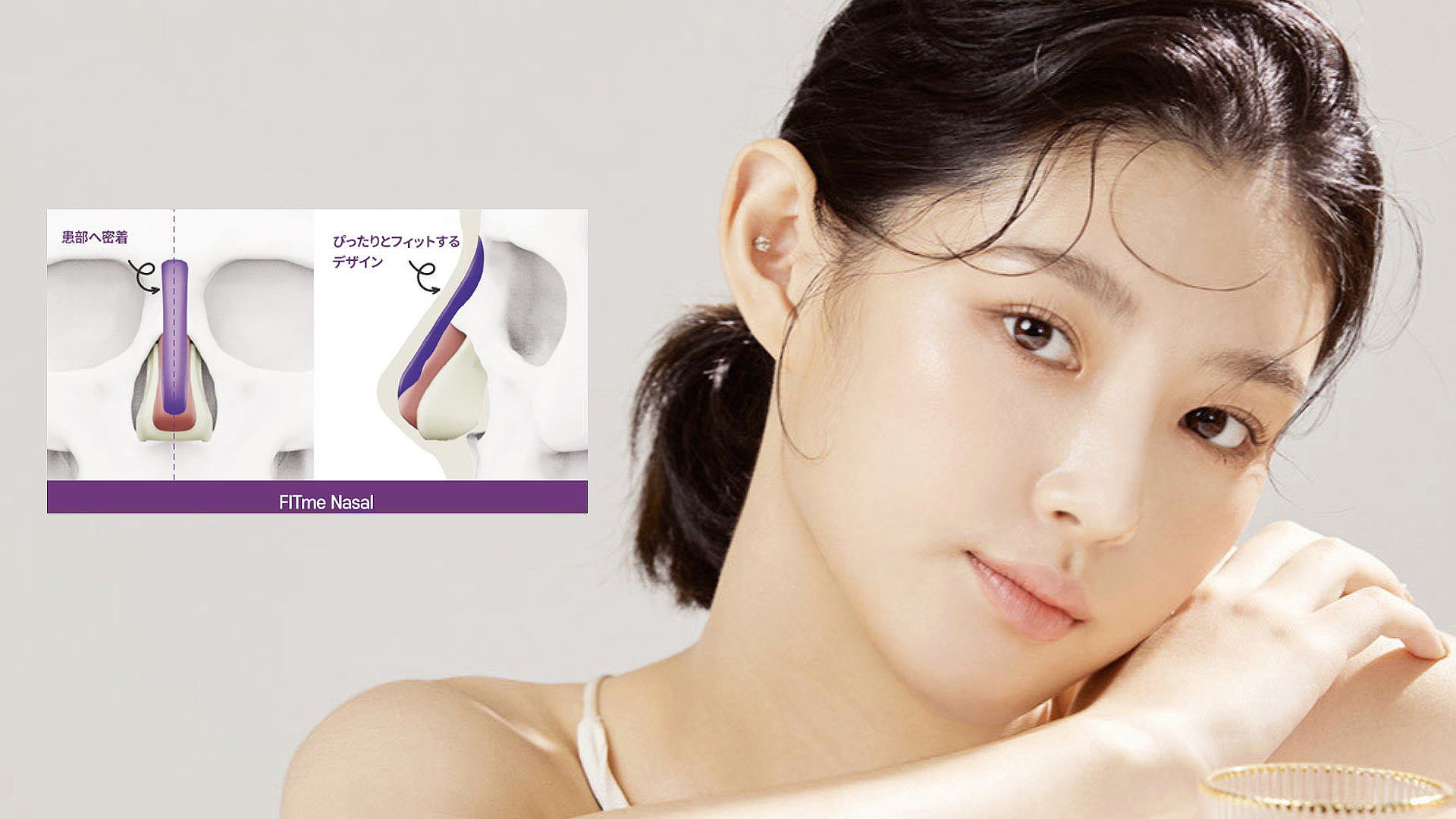 fitme3D隆鼻 嘉義琢丰美學 Chiayi Aesthetic - 隆鼻手術 - 嘉義琢丰美學診所 SculptureClini 嘉義/雲林/台南